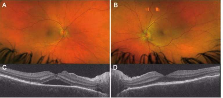 Complications des nouvelles chimiothérapies anticancéreuses - cahiers ...