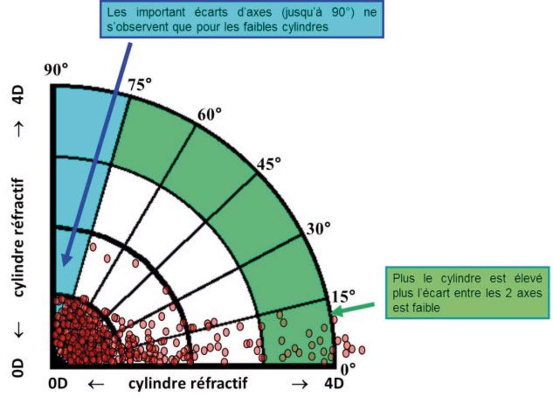 etude de la refraction ophtalmologie