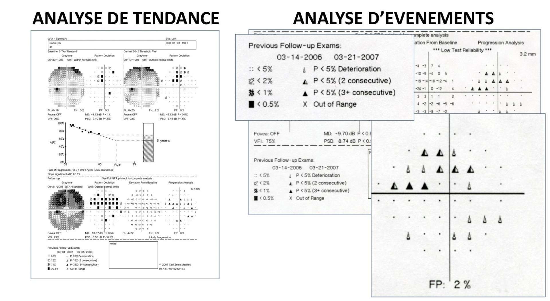 Quand et comment suivre avec un champ visuel ? - cahiers-ophtalmologie